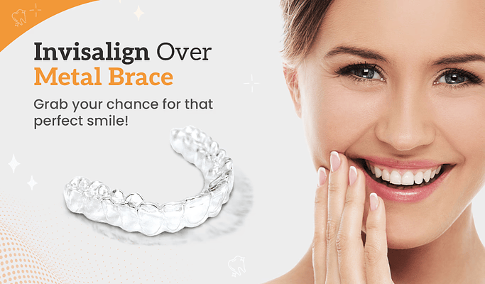 Invisalign: The Clear Alternative to Braces