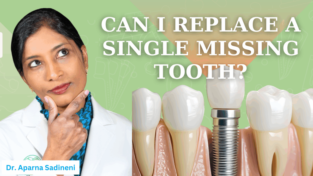 Restore Your Smile with a Single Dental Implant at Dublin Metro Dental ...