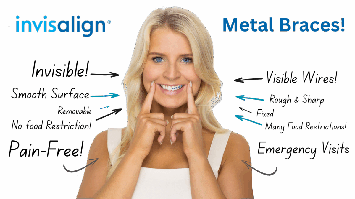 How to Know If You’re a Good Candidate for Invisalign Clear Aligners ...