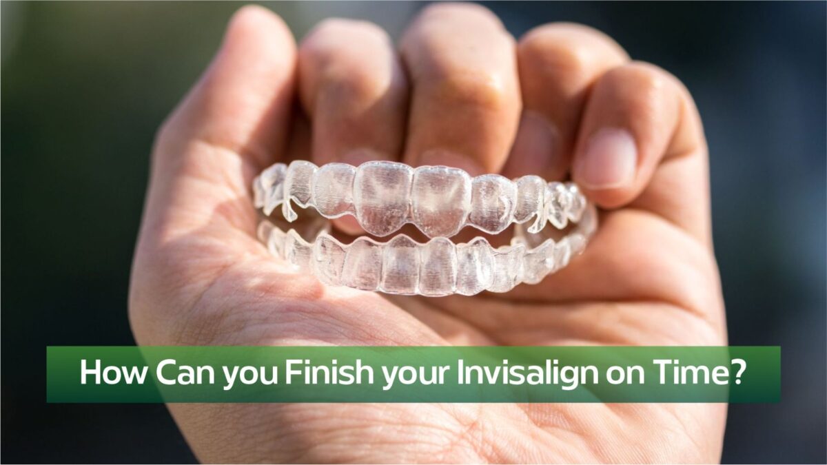 How Can You Finish Invisalign® Treatment on Time? | Dublin Metro Dental ...