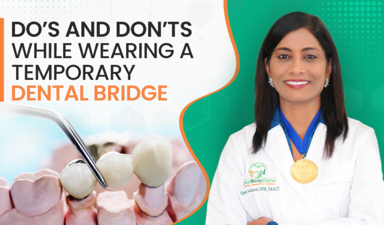Do’s and Don’ts While Wearing a Temporary Dental Bridge | Dublin Metro ...